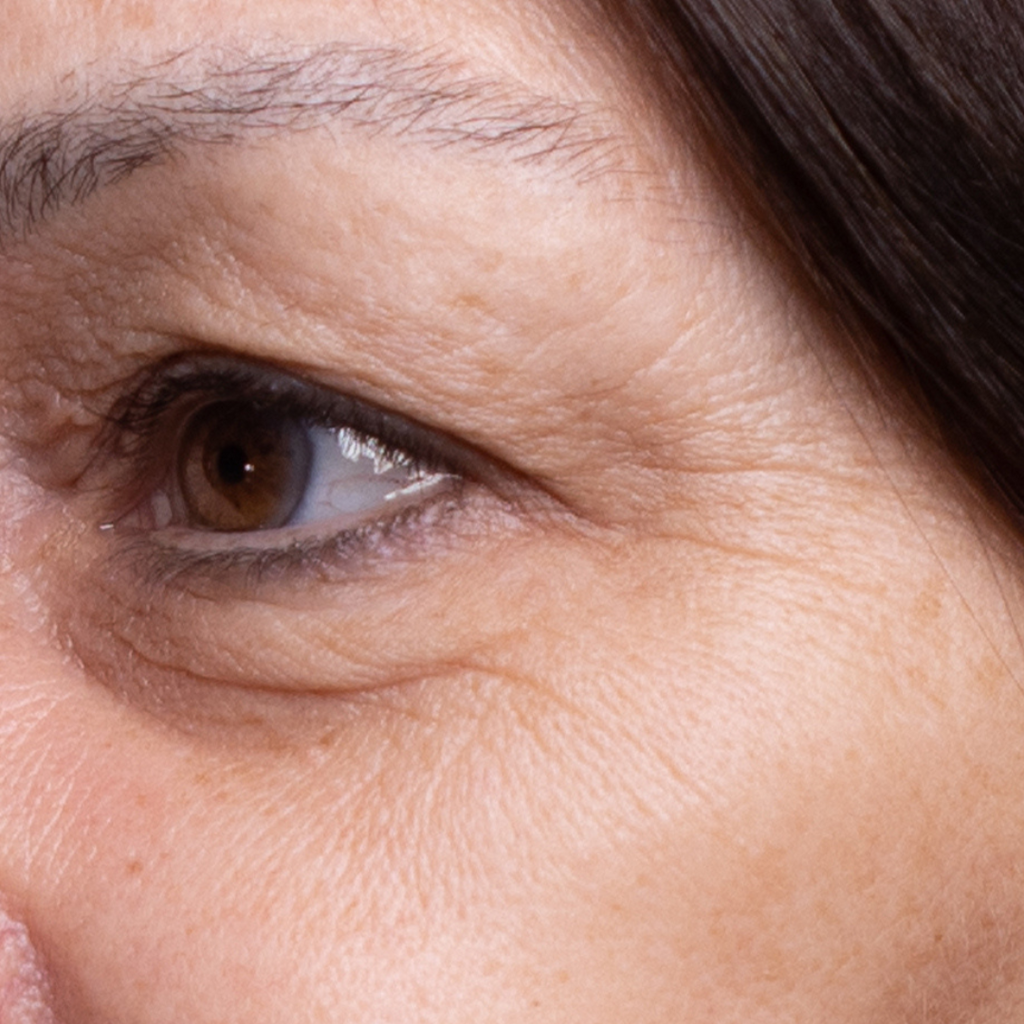 Crows Feet Silicone Eye Patches for Wrinkles at Wrinkles Schminkles