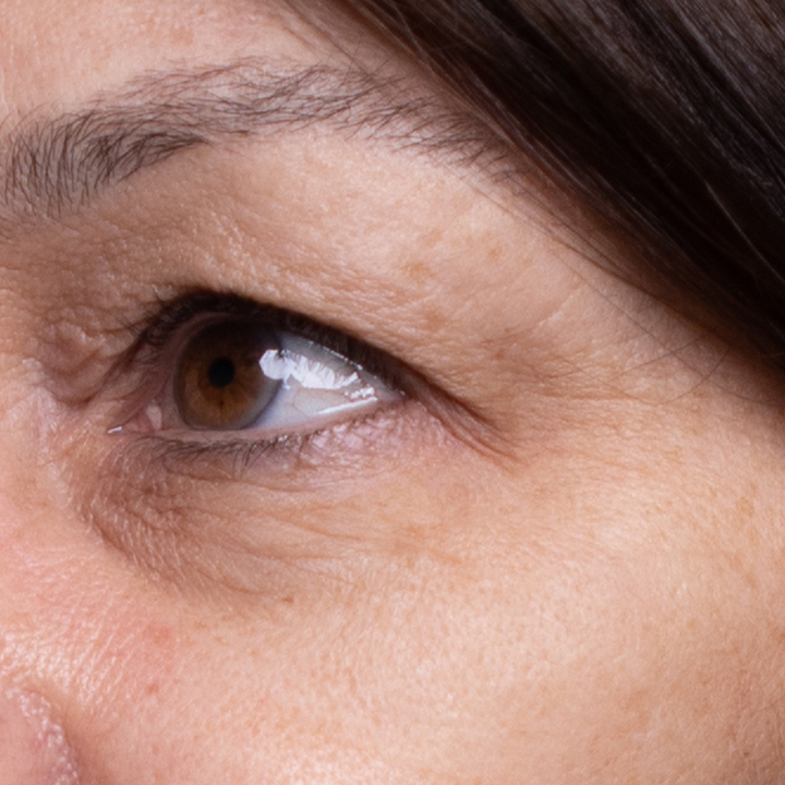 Crows Feet Silicone Eye Patches for Wrinkles at Wrinkles Schminkles